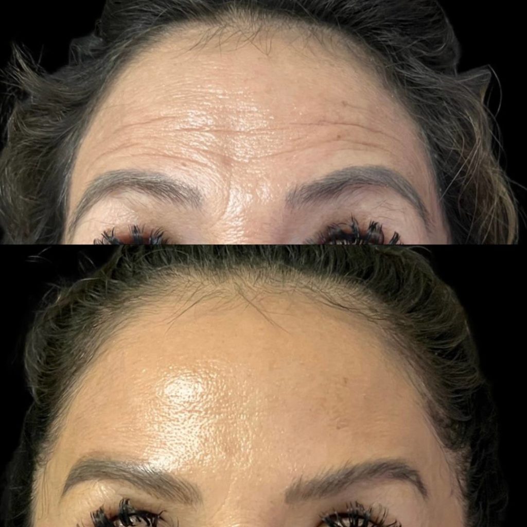 Dr.Bueso – Rinología y Cirugía Plástica Facial. Otorrinolaringología ...